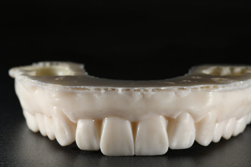 How dental crowns are made step by step in a dental lab?