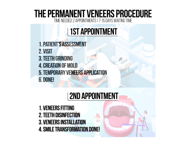 Veneers Procedure: An In-Depth Step by Step Easy Guide